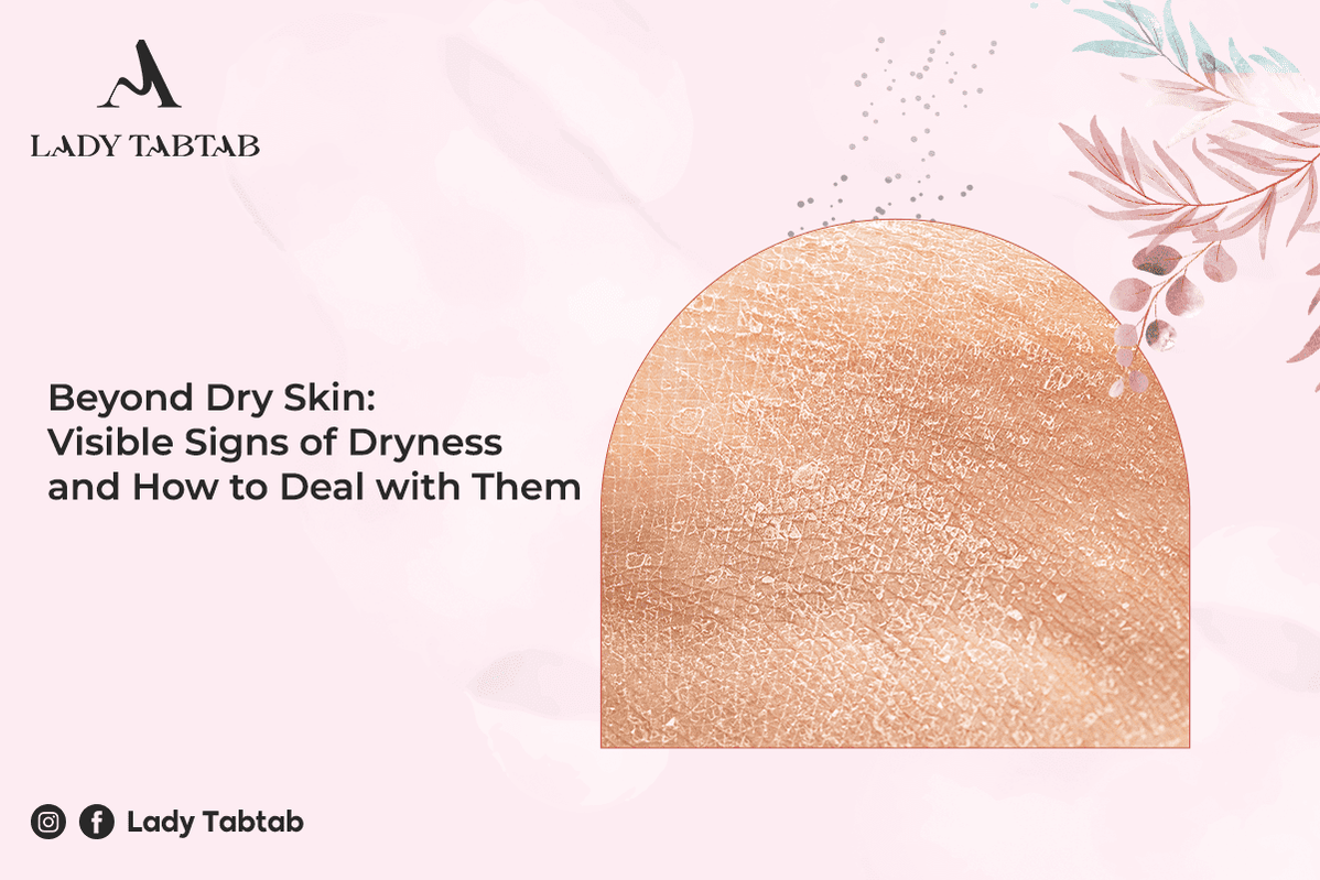 Beyond Dry Skin: Visible Signs of Dryness and How to Deal with Them ...