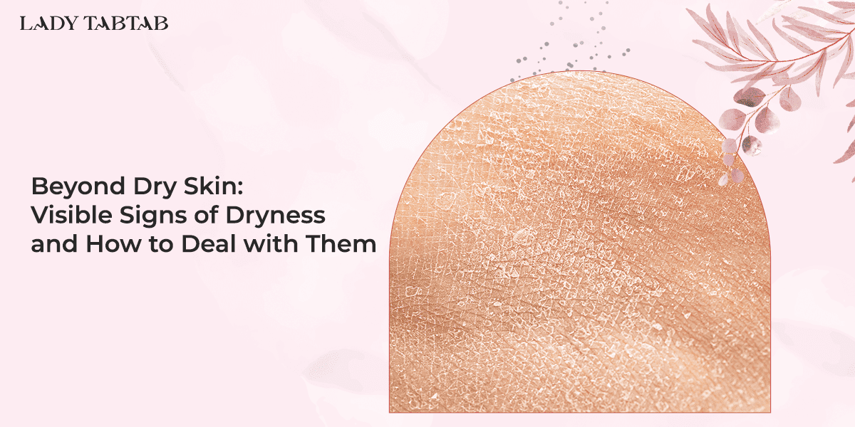 Beyond Dry Skin: Visible Signs of Dryness and How to Deal with Them ...